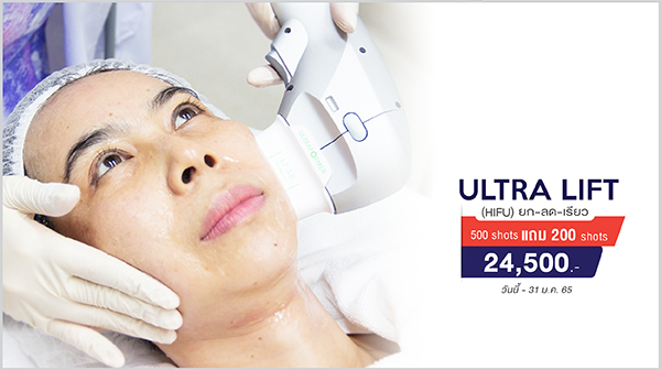 Ultra Lift (Hifu) ยกกระชับปรับรูปหน้า